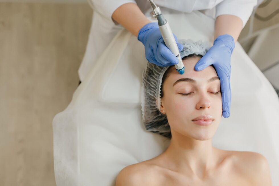 The Power of Microneedling: A Revolutionary Skincare Treatment - Nurse ...